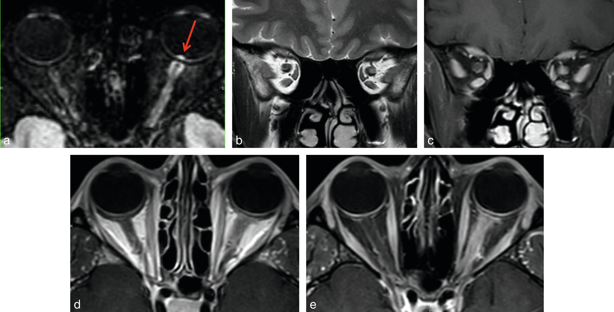 SFO | SFO Rapport Site Generation