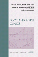 Varus Ankle and Osteochondral Lesions of the Talus - EM consulte