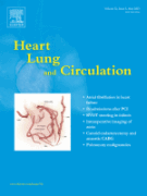 Aberrant Ventricular Conduction: Revisiting an Old Concept - EM consulte