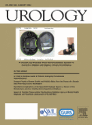 Minimally Invasive Management of Posterior Urethral Stricture/Stenosis ...